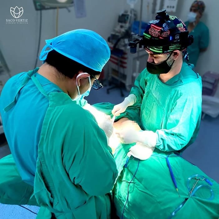 Lipo 360: Abdomen, Laterales, y la Espalda: Liposucción en Lima, Peru