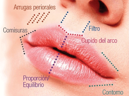 Lifting de Labio Superior para Labios Caídos - Cirugía en Peru