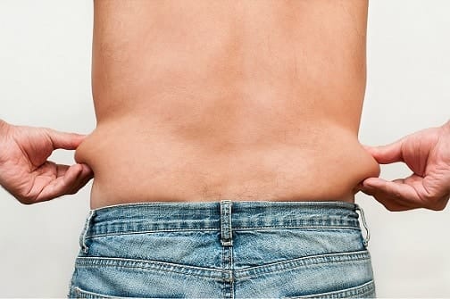 Getting Rid of Love Handles - Surgery in Peru